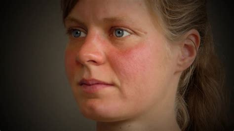 Mimiske Ansigtsmuskler Funktionstest Gyldendal Test