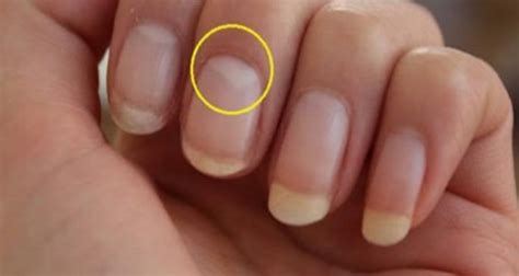 Do You Know What The Half Moon Shape On Your Nails Means The Answer Is