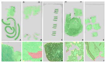 Resolution Agnostic Tissue Segmentation In Whole Slide Histopathology