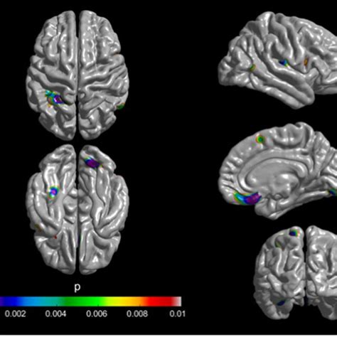 P Value Maps Thresholded At P Download Scientific Diagram