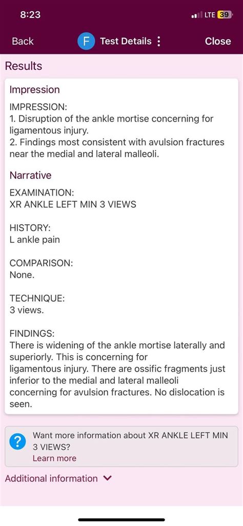 Sprained Ankle Badly 8 Days Ago Have X Ray And Mri Results Hoping