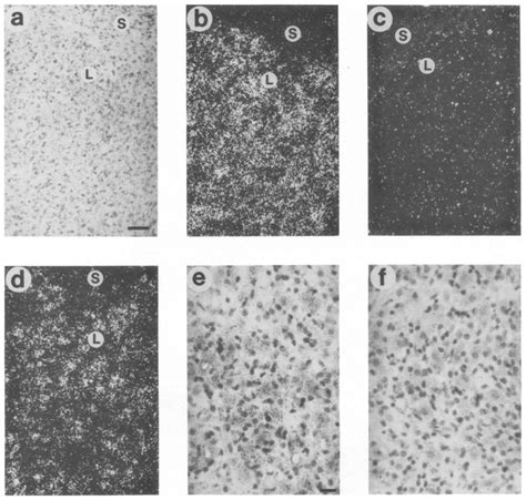 In Situ Localization Of Ovine Scf Mrna Within Cl A Brightfield