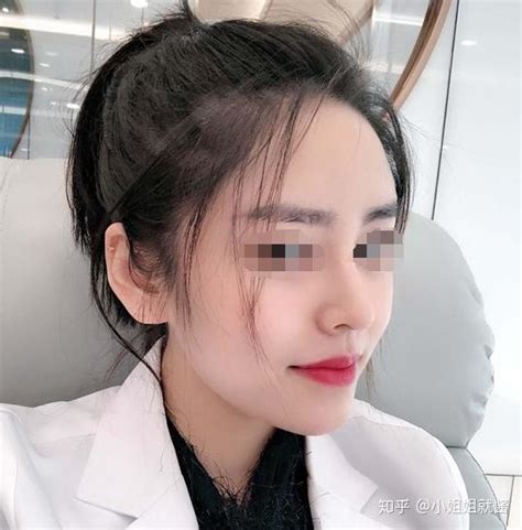 上海半肋膨体隆鼻案例，纯个人经历分享 知乎