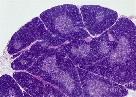 Thymus Histology Diagram
