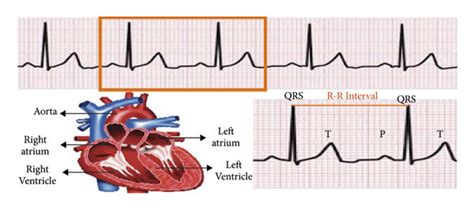 Ecg Signal With P Qrs And T Waves Download Scientific Diagram