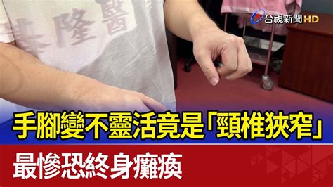 手腳變不靈活竟是「頸椎狹窄」 最慘恐終身癱瘓 Youtube
