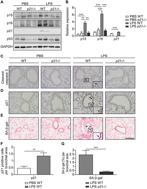 P21 Facilitates Chronic Lung Inflammation Via Epithelial And