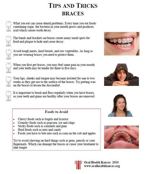 17 Best Images About My Braces Styles On Pinterest Different Types Of Braces Ceramic Braces