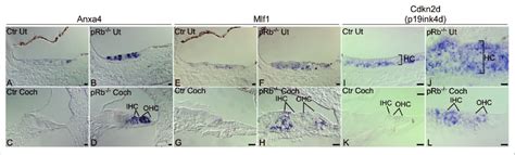 Confirmation Of Microarray Analysis By In Situ Hybridization A D