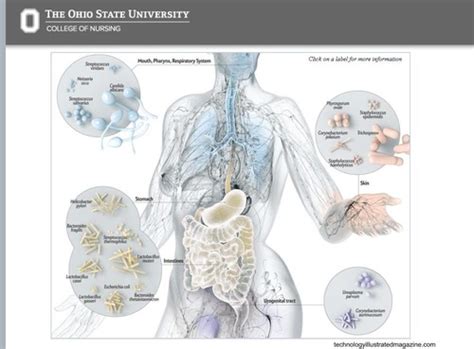 Infection Flashcards Quizlet