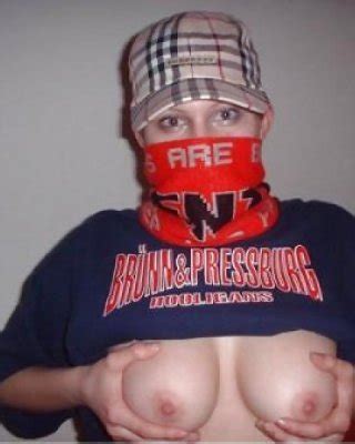 Amateur Skinhead Girl Porn Pictures XXX Photos Sex Images PICTOA