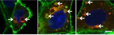 Exosomes