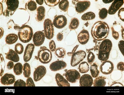 Oolite Light Micrograph Of A Thin Section Through Limestone Showing Ooliths Ooliths Are