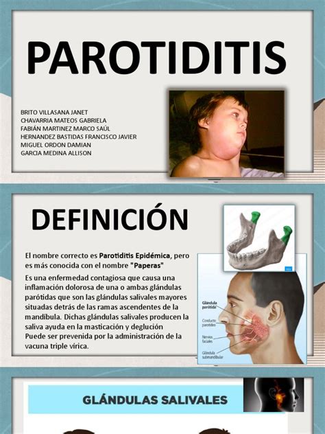 Parotiditis Equipo 11 Pdf Inmunología Enfermedades Y Trastornos