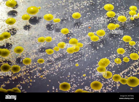 Staphylococcus Epidermidis Colony
