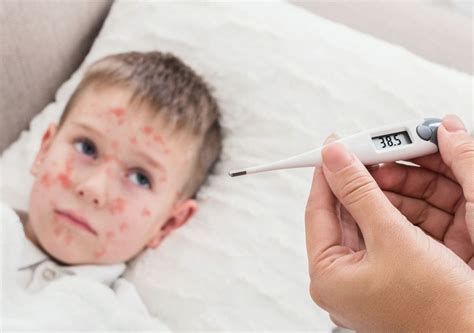 Más Que Pintitas En La Piel ¿por Qué Es Importante Conocer Los