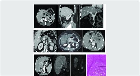 3 Examples To Illustrating The Concept Of Sequential Image Faced With Download Scientific