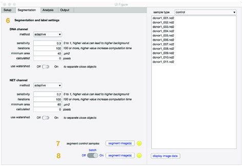 Segmentation Tab For Netquant The Segmentation Parameters Used