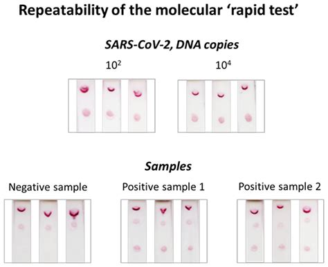 A Molecular Lateral Flow Assay For Sars Cov 2 Quantitative Detection