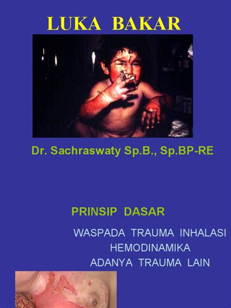 luka bakar pdf