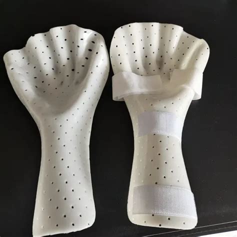 Hand Based Anti Spasticity Ball Splint Thermoplastic Splint Thermoplastic Splint And