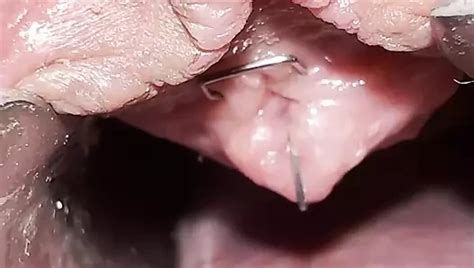 쿠스코의 자궁 경부 관찰 xHamster