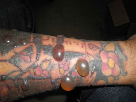 Update 59 Skin Rejecting Tattoo Ink Latest Incdgdbentre