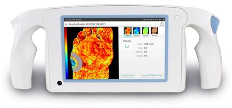Non Invasive Portable Diagnostic Imaging Device To Assess Tissue