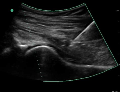 John Kiel Do Mph Facep Caqsm On Linkedin One Of The Classics