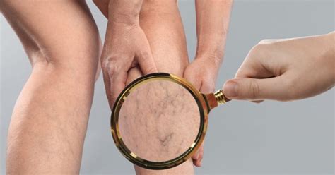 Swollen Preauricular Lymph Nodes Should I Worry Purehealth Research