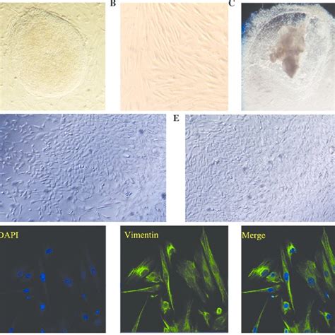 Pdf Co‑culture With Endometrial Stromal Cells Enhances The