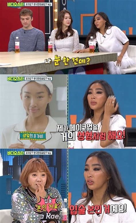 얼굴에서는 눈만…쿨한 성형 고백 문가비 재조명