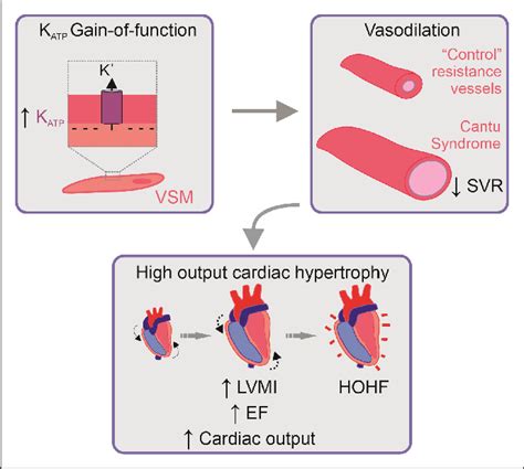 Mechanism Of Cardiovascular Pathophysiology In CS Top Left K ATP