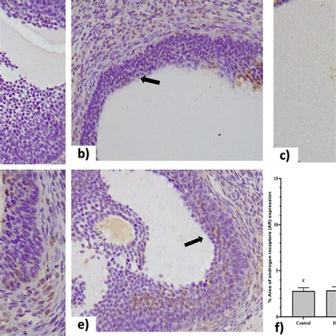 Microscopic Images Show Effect Of Selenium Nanoparticles Senps On The
