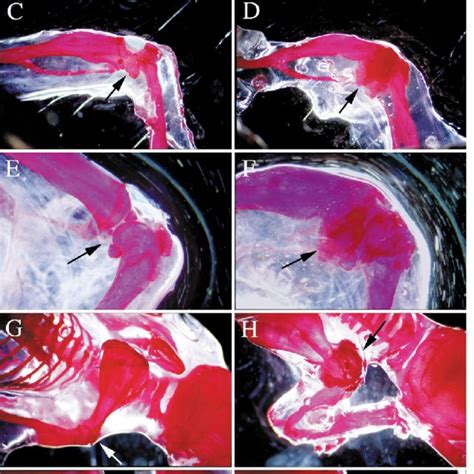 Skeletal Defects In Mt Dniir Transgenic Mice Photographs Of Alizarin