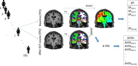 Ect Brain