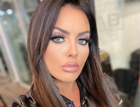 Mandy Rose In Bathing Suit Says My Sunburn Lol — Celebwell