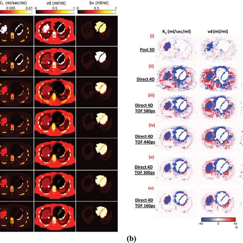 True A I And Estimated Kinetics Parameter Maps Using Download
