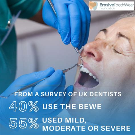 Do You Use Bewe For Tooth Wear Erosive Tooth Wear Foundation Posted On The Topic Linkedin
