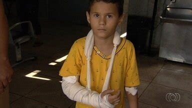 JA 2ª Edição Pacientes reclamam da falta de gesso no Crof em Goiânia