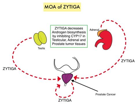 Fda Approves Zytiga® For High Risk Metastatic Castration Sensitive