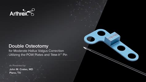Arthrex Chevron Osteotomy