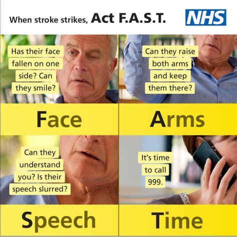 When Stroke Strikes Act Fast Wellington Practice