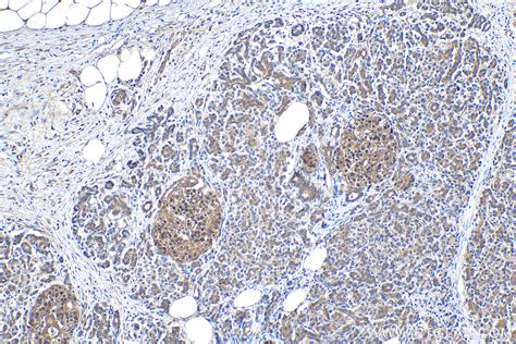 IHCeasy NR3C2 Ready To Use IHC Kit KHC1514 Proteintech 武汉三鹰生物技术有限公司