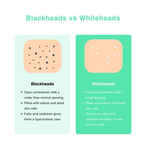How To Safely Close Blackhead Holes Goodglow