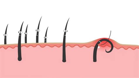 Apsces Invita Hirurgija 11000 Beograd
