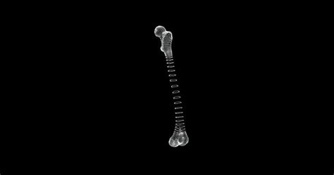 X Ray Bone Stock Video Footage For Free Download