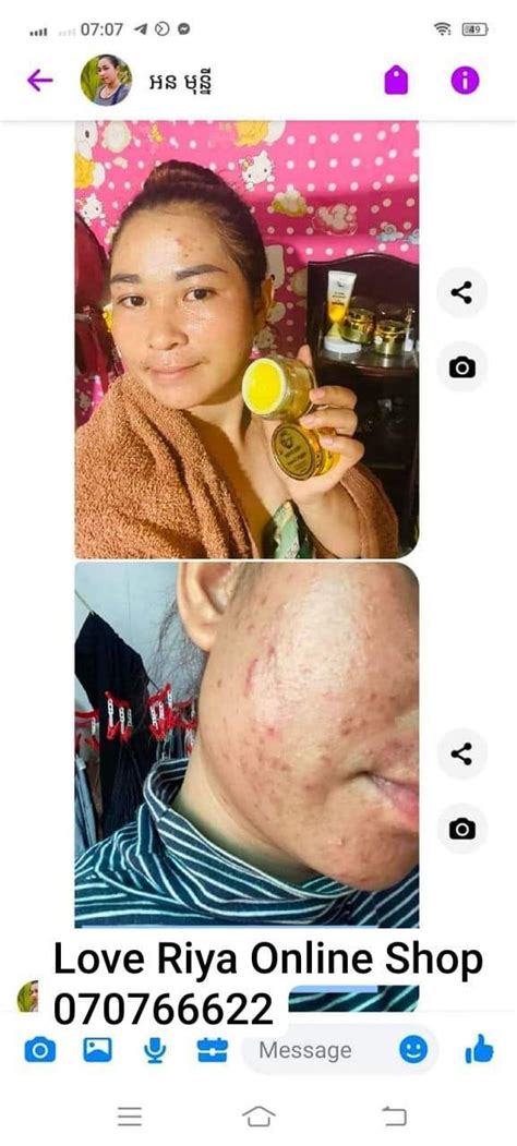 🥰ចង់បាន ផ្ទៃមុខ សស្អាត ទន់ម៉ត Love Riya Online Shop Facebook