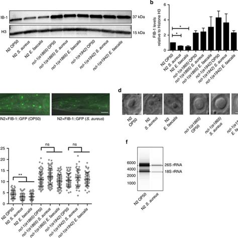 Fib 1 Fibrillarin Regulates Bacterial Infection Resistance In C Download Scientific Diagram