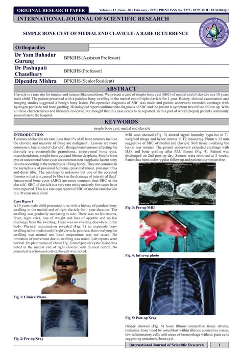 Pdf Simple Bone Cyst Of Medial End Clavicle A Rare Occurence